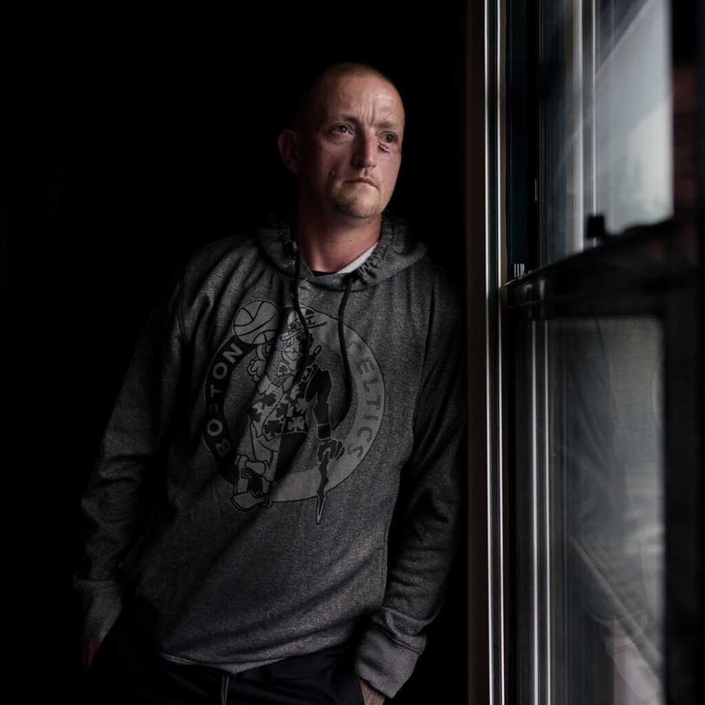 Prison guards beat him and shattered his face. Eight years later, this ...